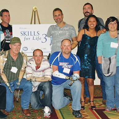 Workshop for Bilateral Upper-limb Amputees Scheduled for October ...